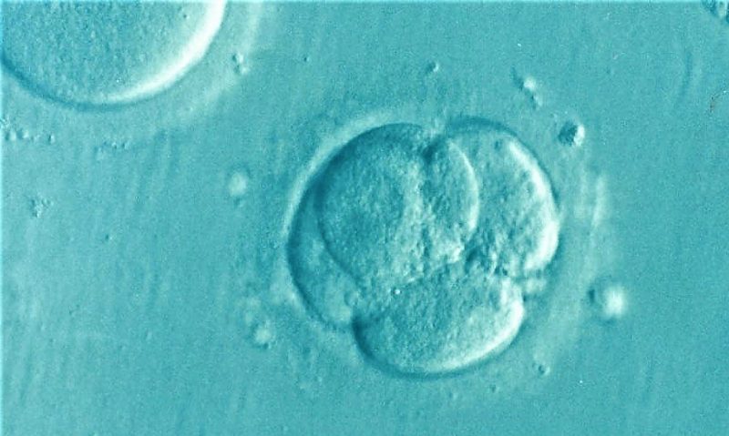 Ontogeny | What is, etymology, study, human, animal, sleep, language,